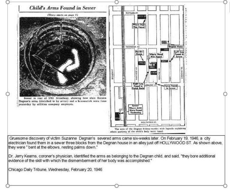 LA and Chicago Autopsy Reports Confirm a Skilled Surgeon Performed ...