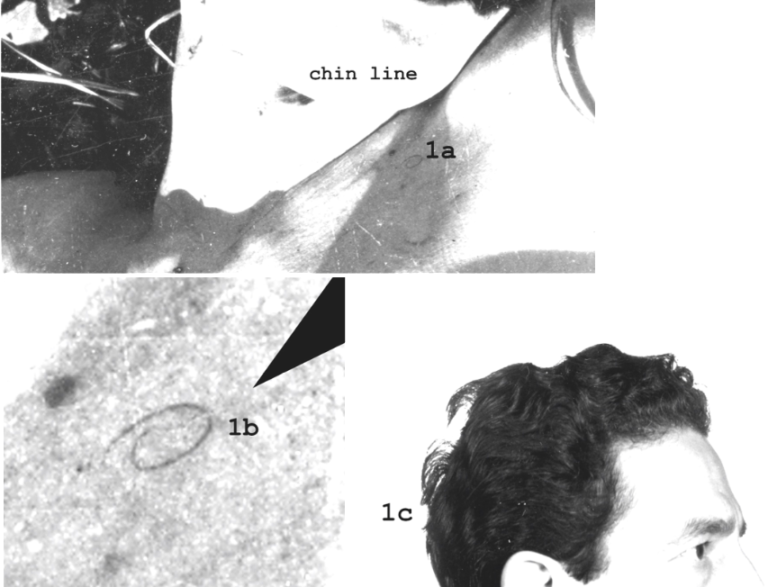 Black Dahlia Crime Scene Photos and Forensics Part II - "The Earring ...